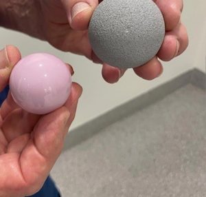 Ceramic Hip Resurfacing - Dr. Anthony Spriggins