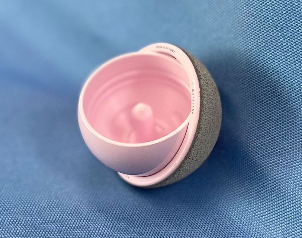 Spriggins Othropaedics - Hip and Knee joint surgeon